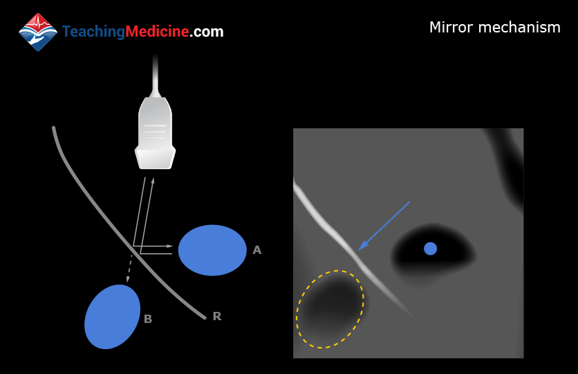 Teaching Medicine - Tutorial: Ultrasound Physics without Physics